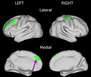 Researchers study children at risk for Tourette syndrome - The Source ...