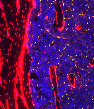 Discovery in bone marrow may improve chemotherapy, stem cell ...