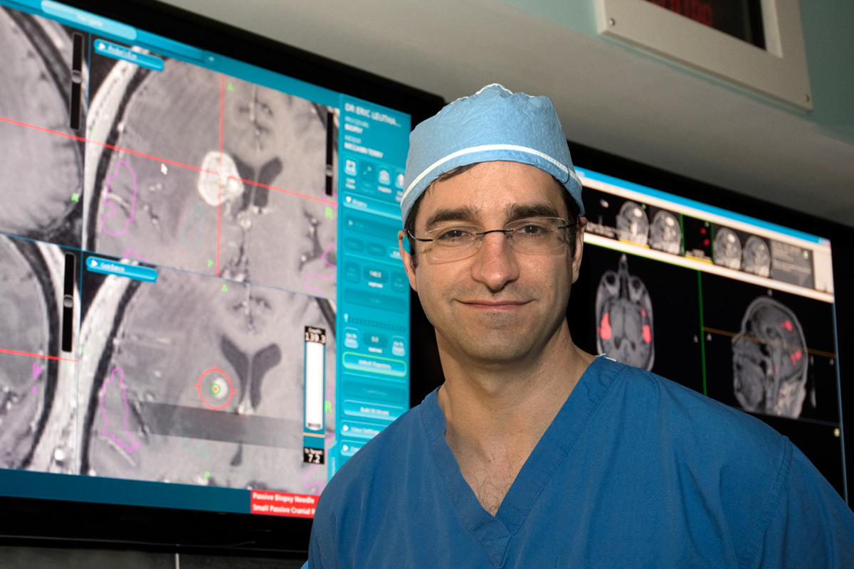 Laser surgery opens blood-brain barrier to chemotherapy - The Source ...