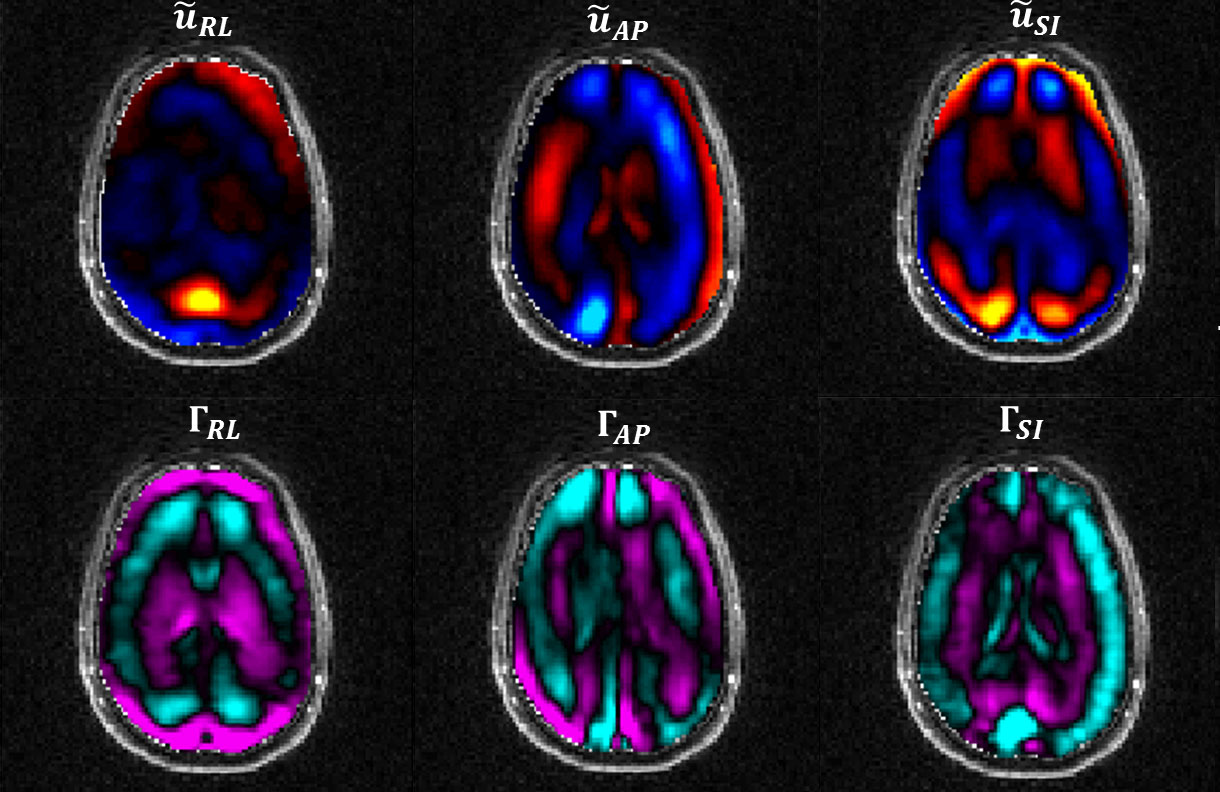 Studying the brain’s suspension system in TBIs - The Source - WashU
