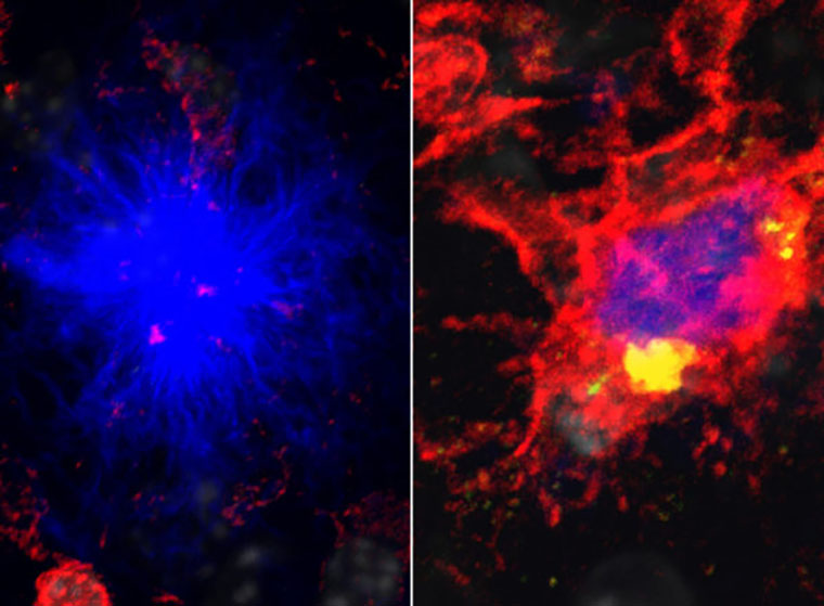 Alzheimer’s risk linked to energy shortage in brain’s immune cells ...