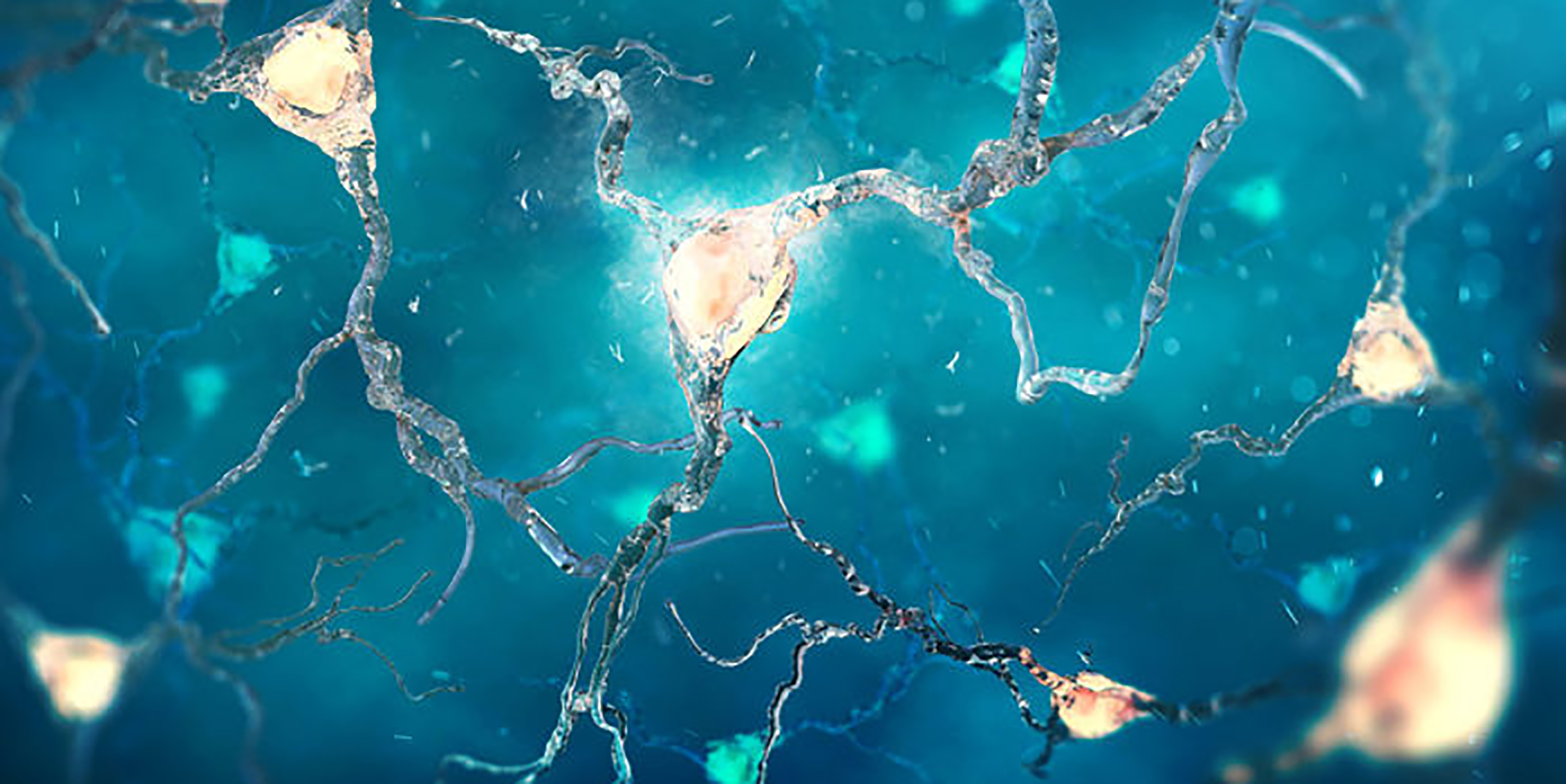 Link between two key Alzheimer’s proteins explained - The Source - WashU