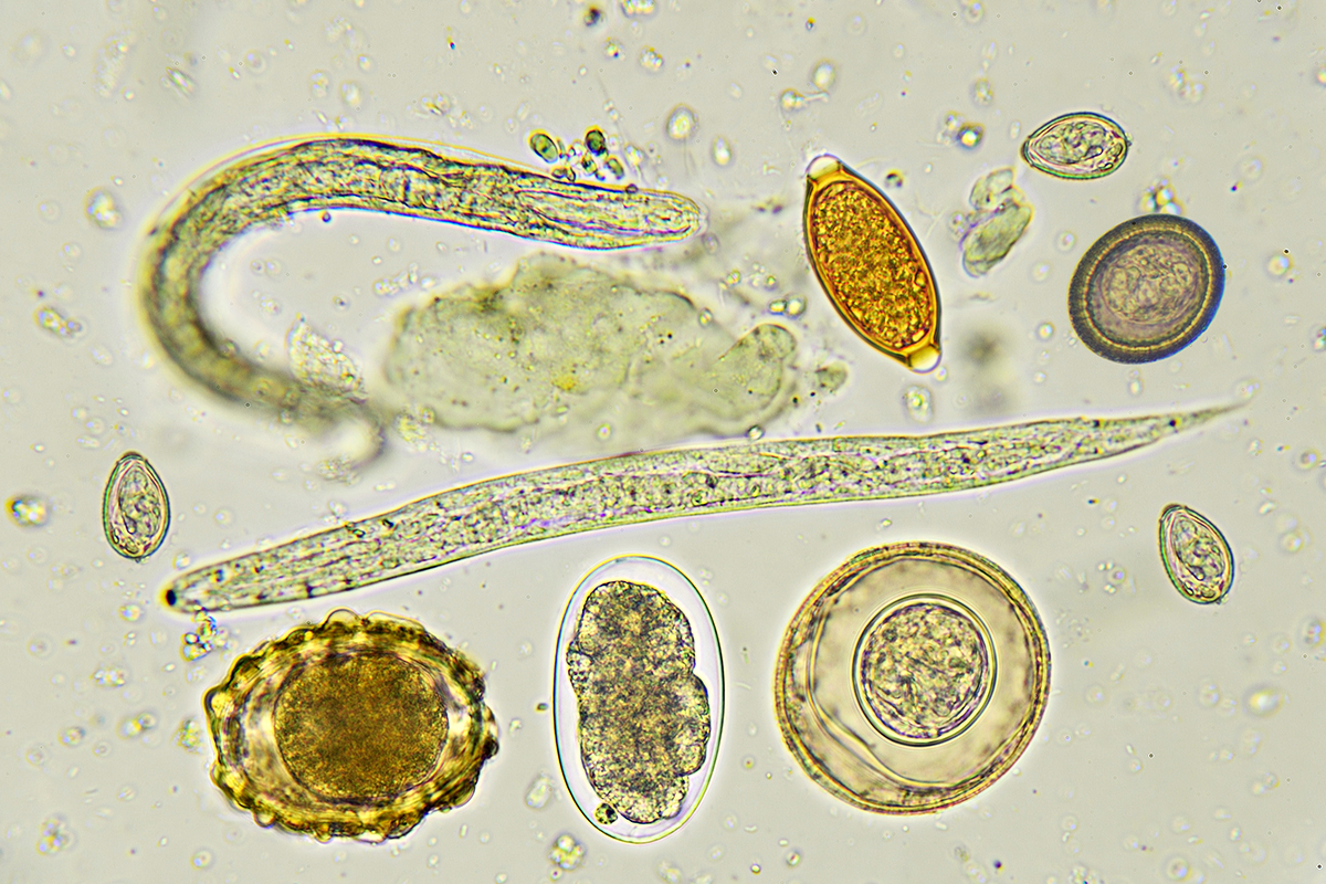 Gut microbes influence severity of intestinal parasitic infections ...