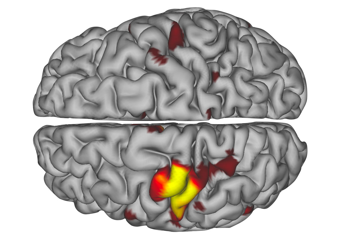 Previously undetected brain pulses may help circuits survive disuse ...