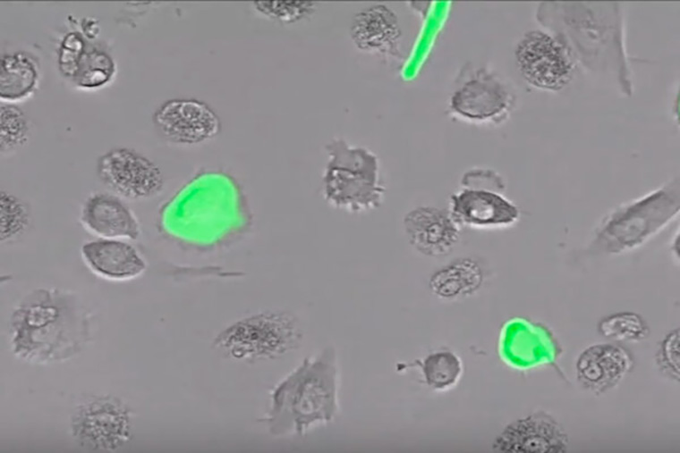 Human immune cells have natural alarm system against HIV - The Source ...