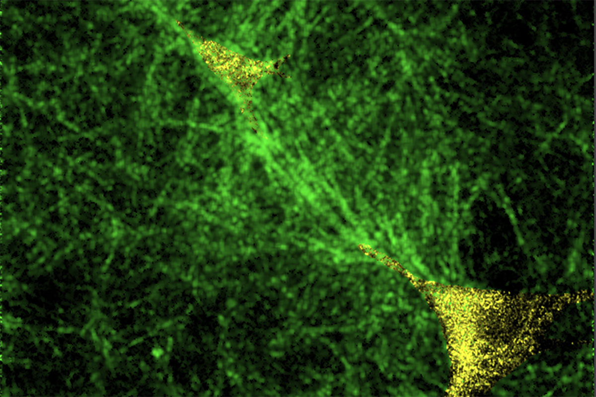 Tissue ‘tipping points’: How cells collectively switch from healthy to ...